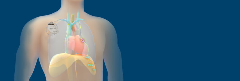 Clinicians Home | remedē® System