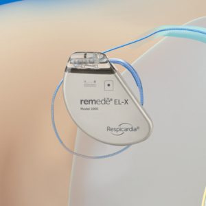 Innovative treatment for Central Sleep Apnea | remedē® System